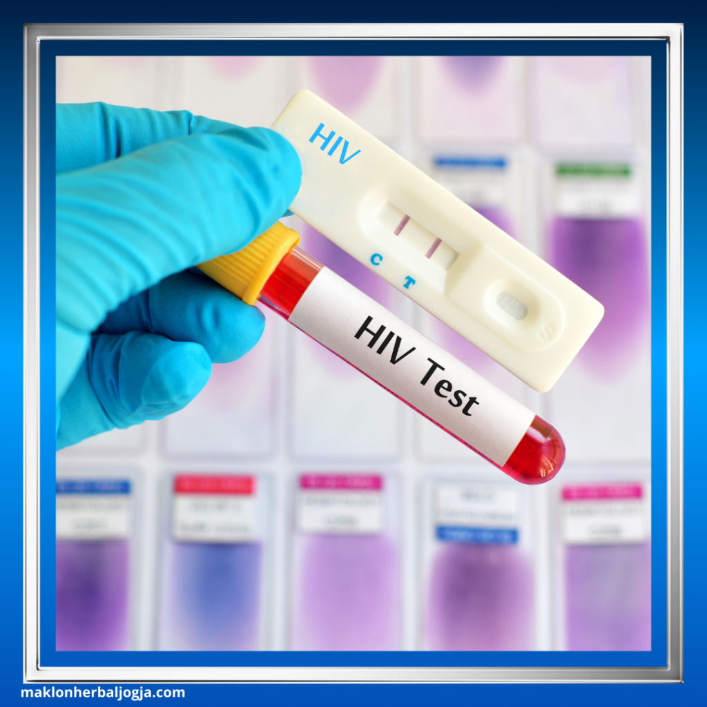 Mengenal HIV : Penyebab, Gejala, dan Cara Penularannya