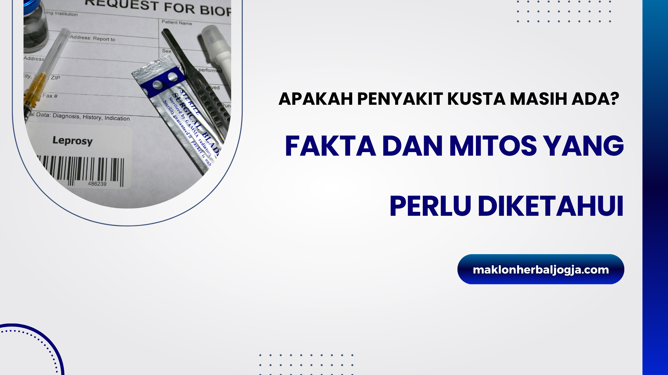 Apakah Penyakit Kusta Masih Ada? Fakta dan Mitos